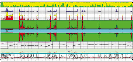 Designing limited-entry fracture completions for horizontal wells